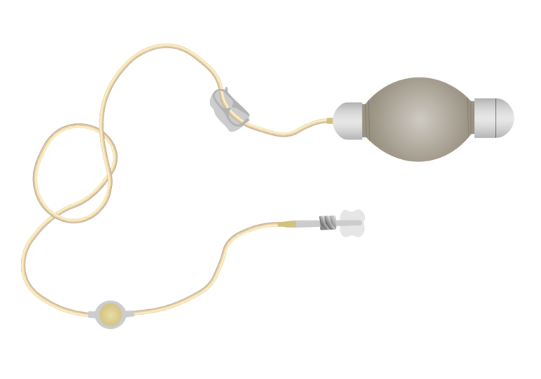 Intro To Infusion: Administration Methods & Infusion Devices